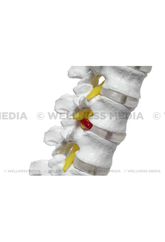 Lumbar Spine Anatomy Model