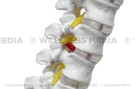 Lumbar Spine Anatomy Model