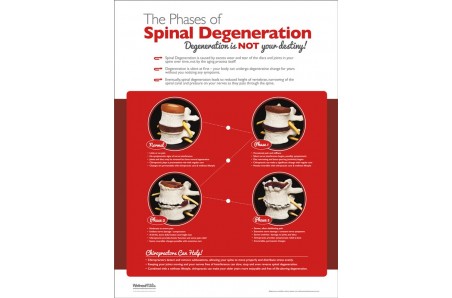 The Phases of Spinal Degeneration Poster